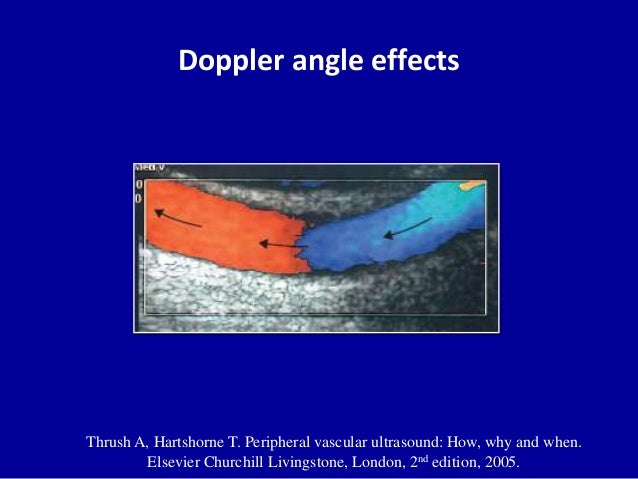Principles of Doppler ultrasound