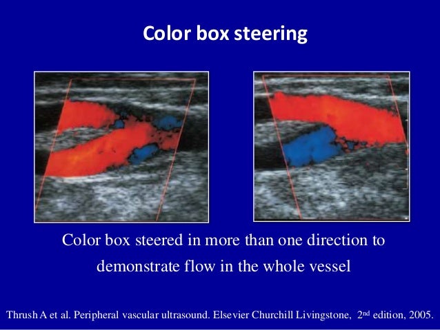 Principles of Doppler ultrasound