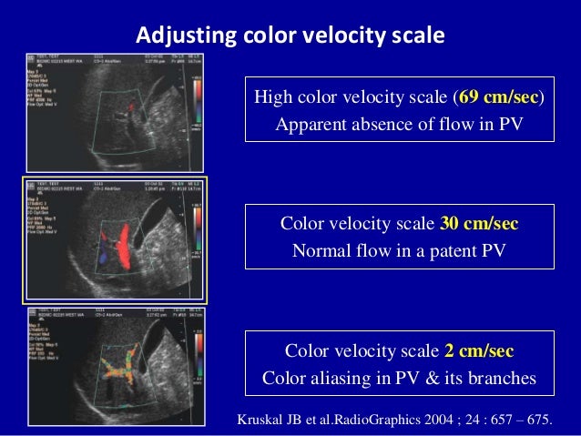 Principles of Doppler ultrasound