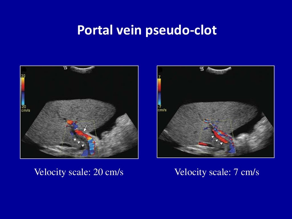 Principles of Doppler ultrasound
