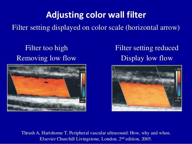 Principles of Doppler ultrasound