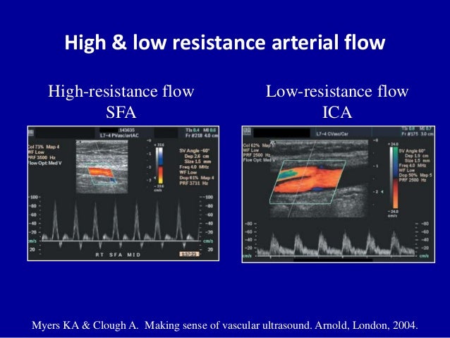 Principles of Doppler ultrasound