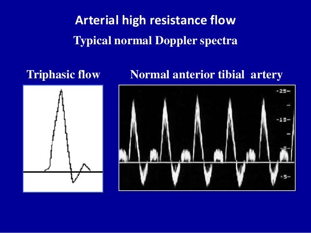 Principles of Doppler ultrasound