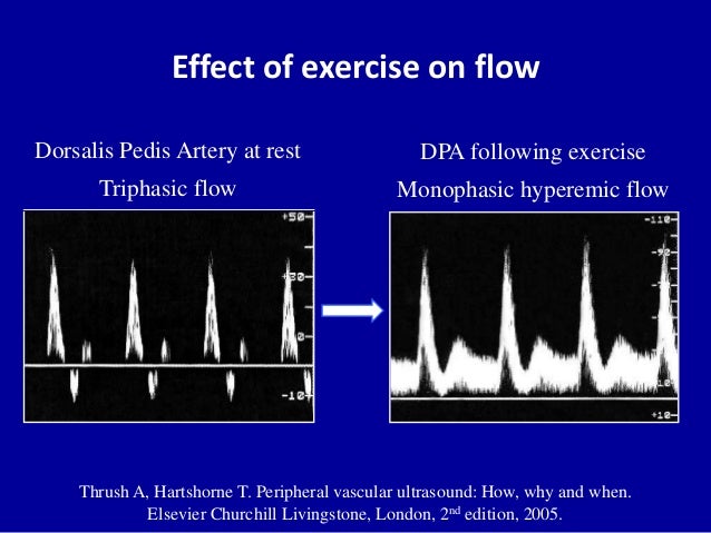 Principles of Doppler ultrasound