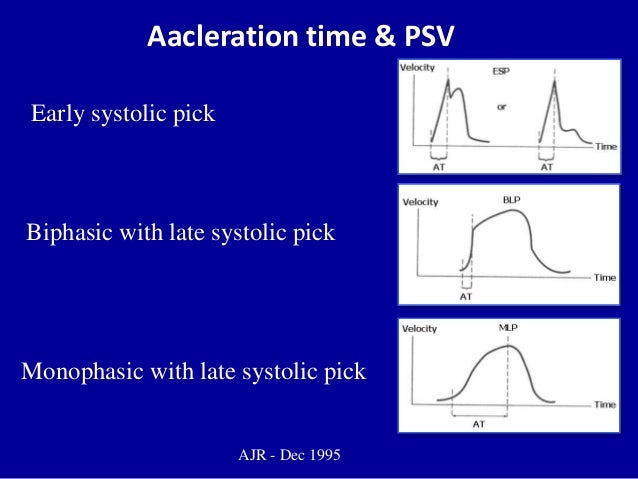 Principles of Doppler ultrasound