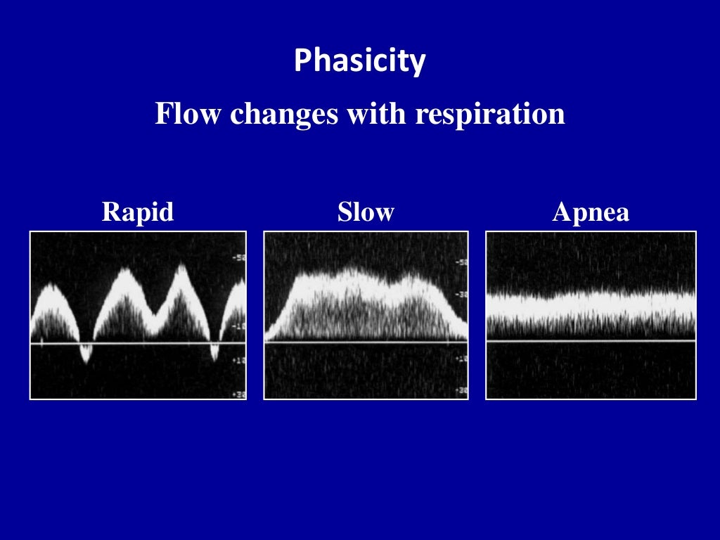 Principles of Doppler ultrasound