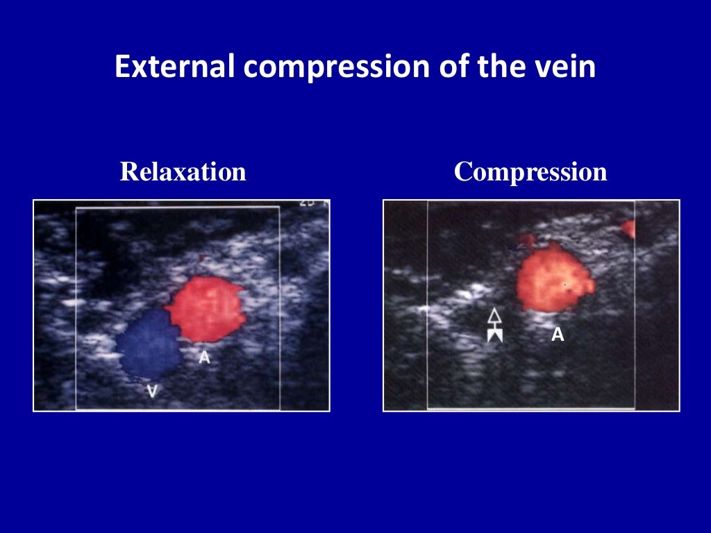 Principles of Doppler ultrasound