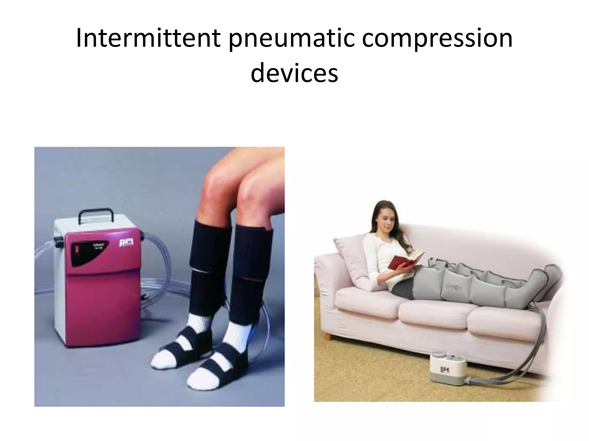 Principles of dvt prophylaxis | PPTX