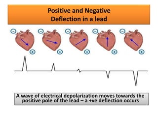 ECG Waveform Explained: EKG Labeled Diagrams And Components, 47% OFF