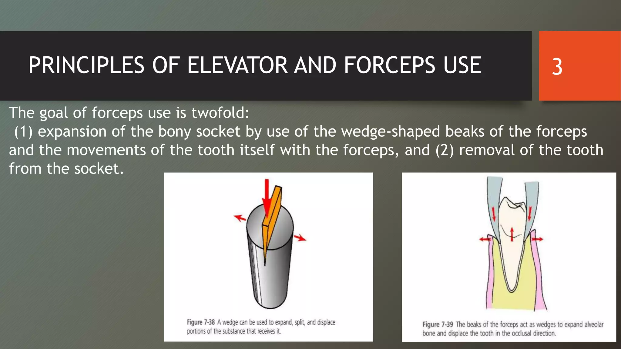 Principles of elevator and forceps use (Dentistry) | PPTX