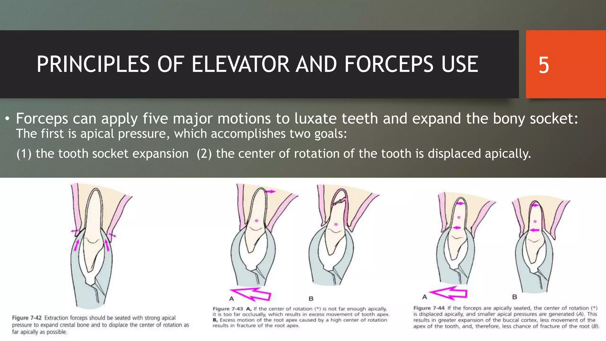 Principles of elevator and forceps use (Dentistry) | PPTX