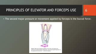 Principles of elevator and forceps use (Dentistry) | PPTX