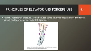 Principles of elevator and forceps use (Dentistry) | PPTX