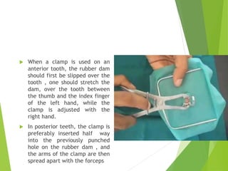 Principles of endodontic treatment | PPTX