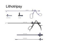Principles of Endourology | PPTX
