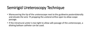 Principles of Endourology | PPTX