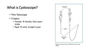 Principles of Endourology | PPTX