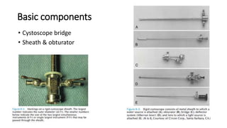Principles of Endourology | PPTX