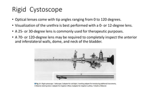 Principles of Endourology | PPTX