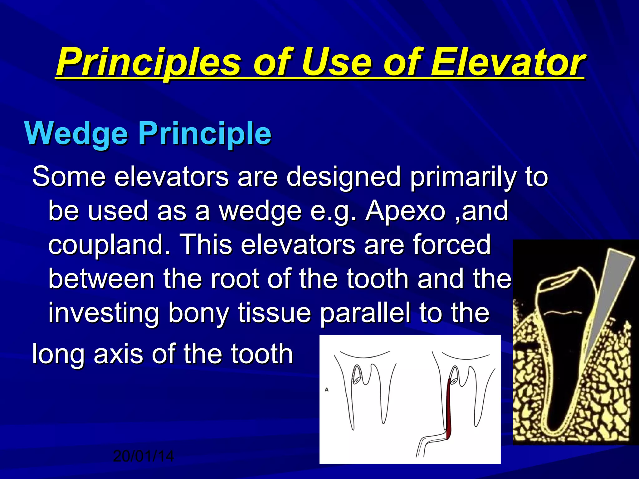 Principles of Exodontia | PPT