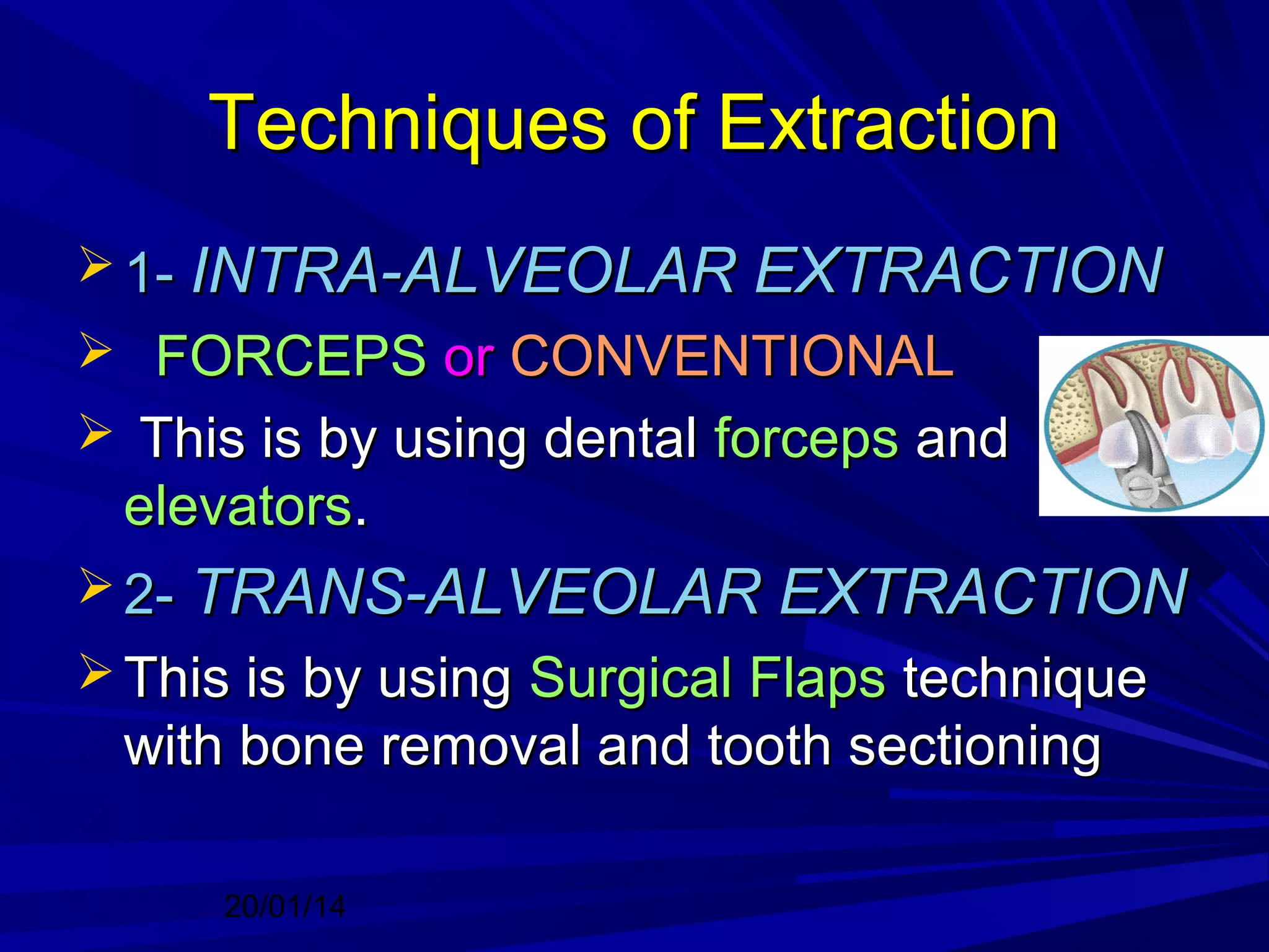 Principles of Exodontia | PPT