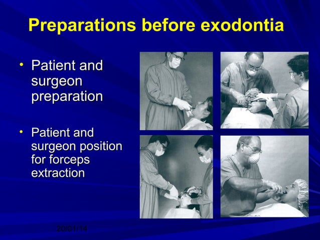Principles of Exodontia | PPT | Oral care | Personal Care