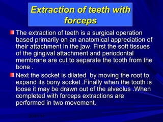 Principles of Exodontia | PPT