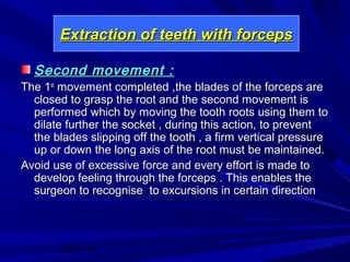 Principles of Exodontia | PPT