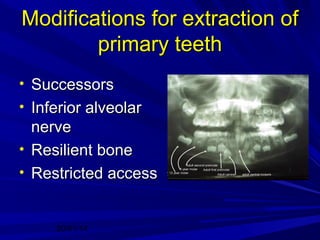 Principles of Exodontia | PPT