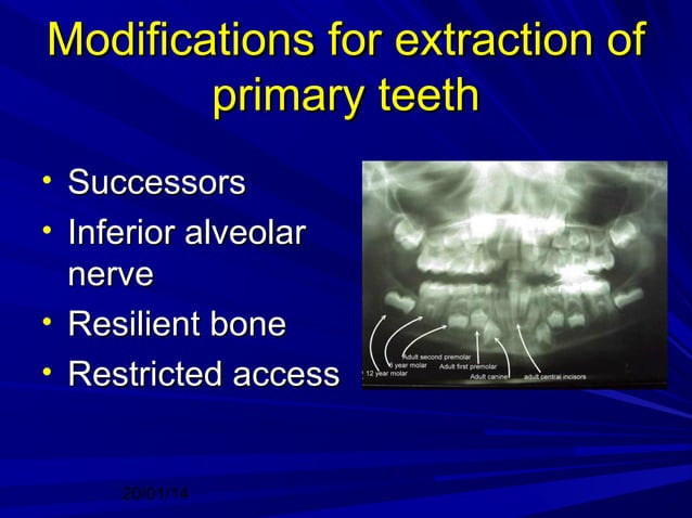 Principles of Exodontia | PPT | Oral care | Personal Care
