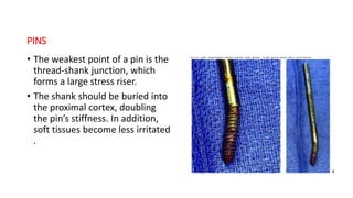 Principles of external fixation | PPTX