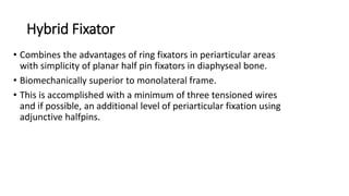 Principles of external fixation | PPTX