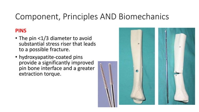 Principles of external fixation | PPTX