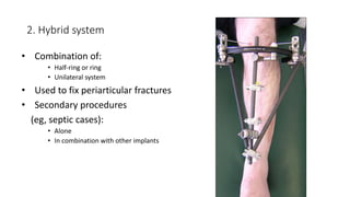 Principles of external fixation.pptx
