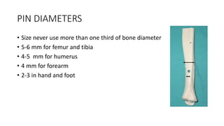 Principles of external fixation.pptx