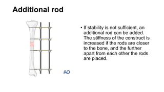 Principles of external fixation.pptx