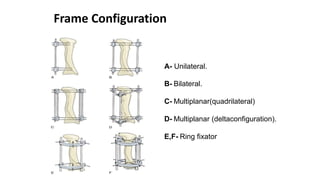 Principles of external fixation.pptx