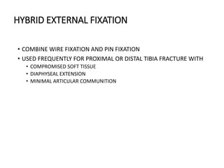 Principles of external fixation | PPTX