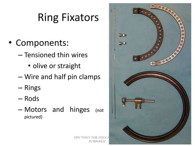Principles of external fixator | PPT | First Aid | Injuries