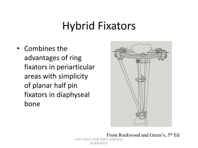 Principles of external fixator | PPT | First Aid | Injuries
