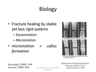 Principles of external fixator | PPT