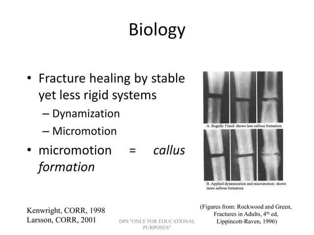 Principles of external fixator | PPT | First Aid | Injuries