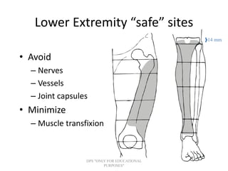 Principles of external fixator | PPT