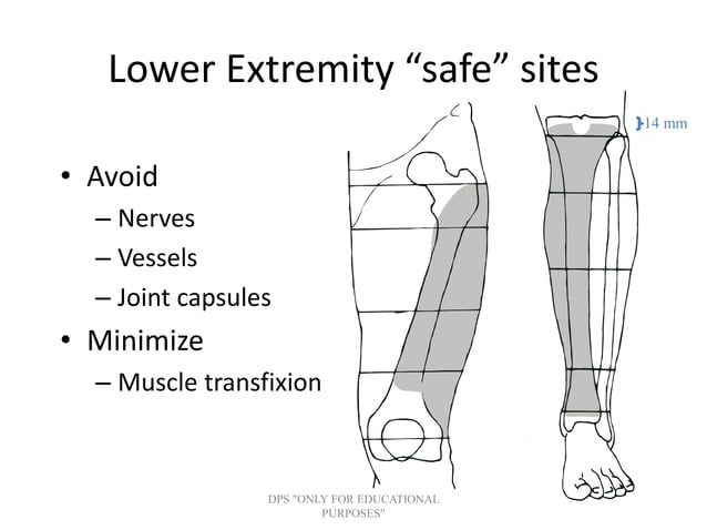 Principles of external fixator | PPT | First Aid | Injuries