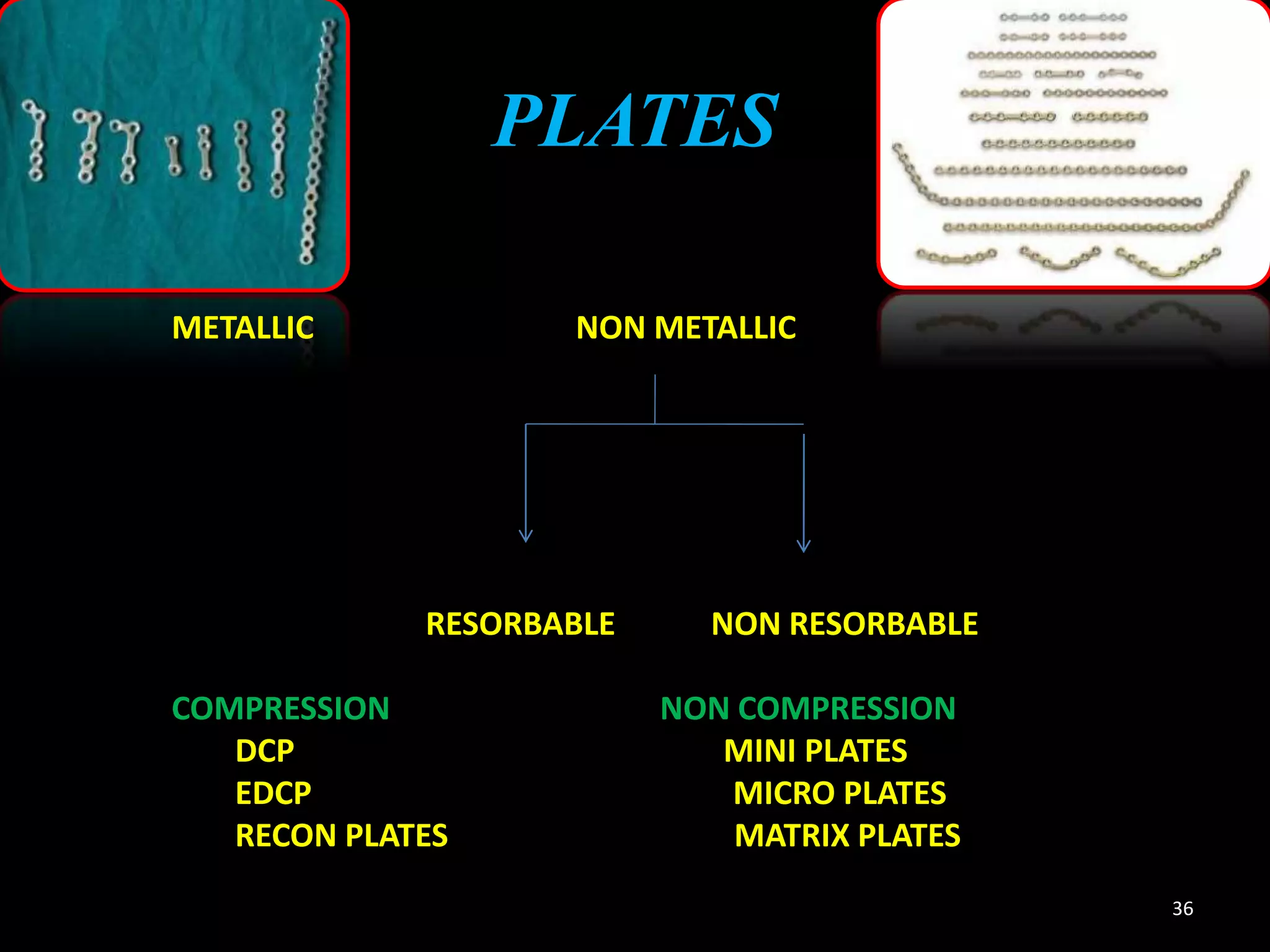 Principles of fixation and osteosynthesis in trauma | PPT