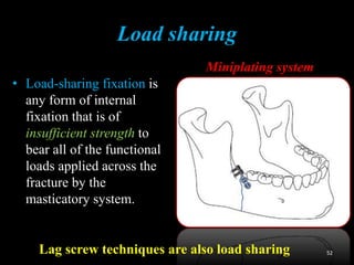 Principles of fixation and osteosynthesis in trauma | PPT