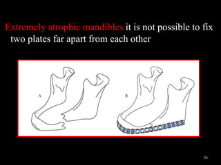 Principles of fixation and osteosynthesis in trauma | PPT