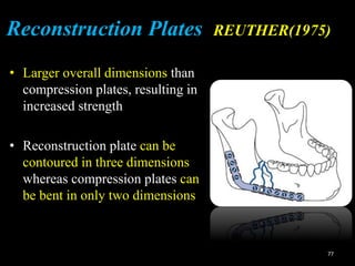 Principles of fixation and osteosynthesis in trauma | PPT