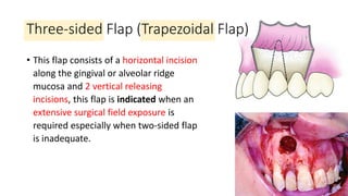 Principles of Flaps, Suturing and Management of difficult extraction.pdf