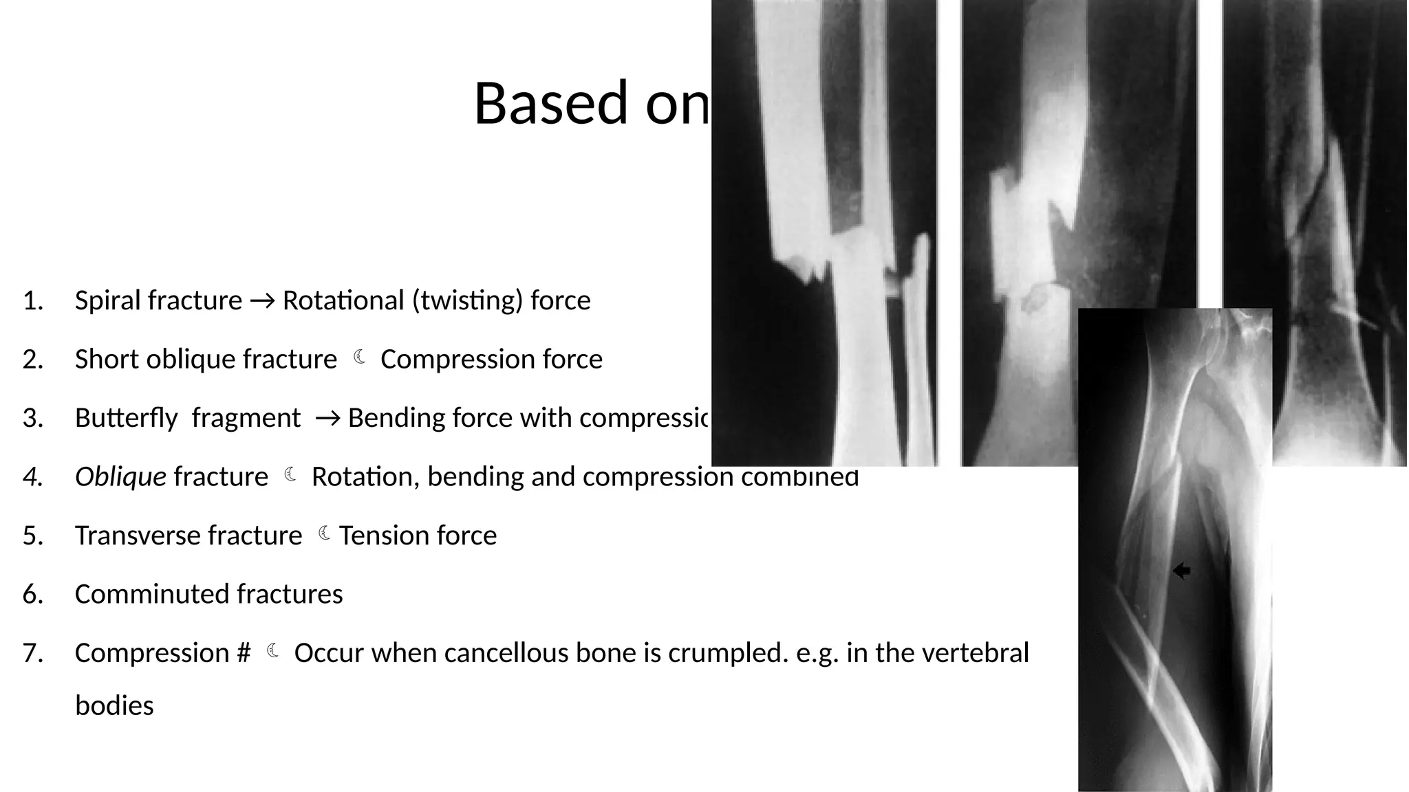 PRINCIPLES OF FRACTURE.pptx of medicine p | PPTX